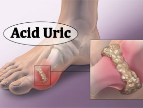 Acid Uric Trong Xét Nghiệm Máu Hiểu Rõ Và Kiểm Soát Hiệu Quả